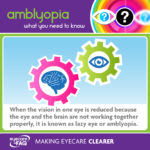 Amblyopia and lazy eye frequently asked questions from eyecareFAQ
