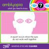 Amblyopia and lazy eye frequently asked questions from eyecareFAQ