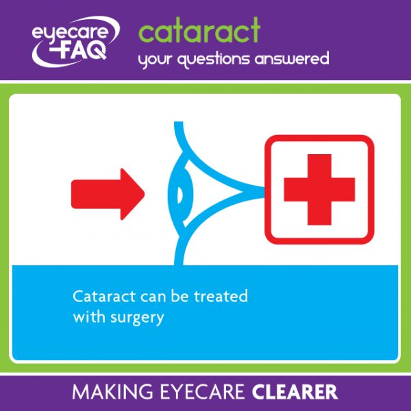 Cataract what you need to know from eyecareFAQ