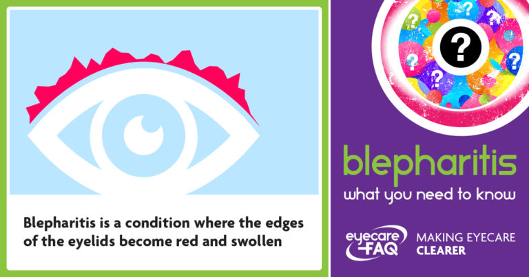 Blepharitis - what you need to know from eyecareFAQ