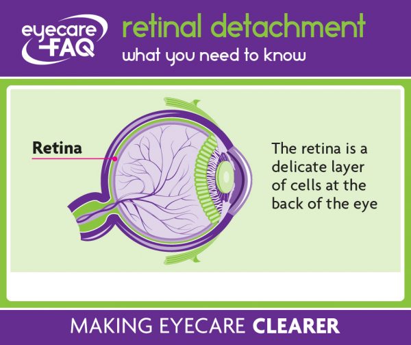 Retinal Detachment - ABDO
