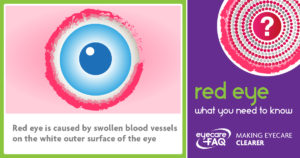 Red eye what you need to know from eyecareFAQ
